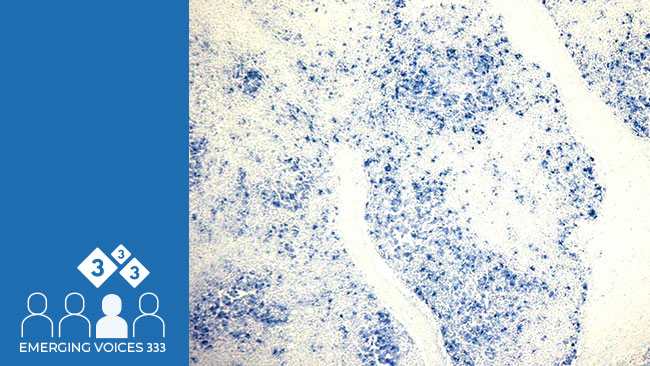 Comparative histopathological findings of diseased pigs with PCV2&3 ...